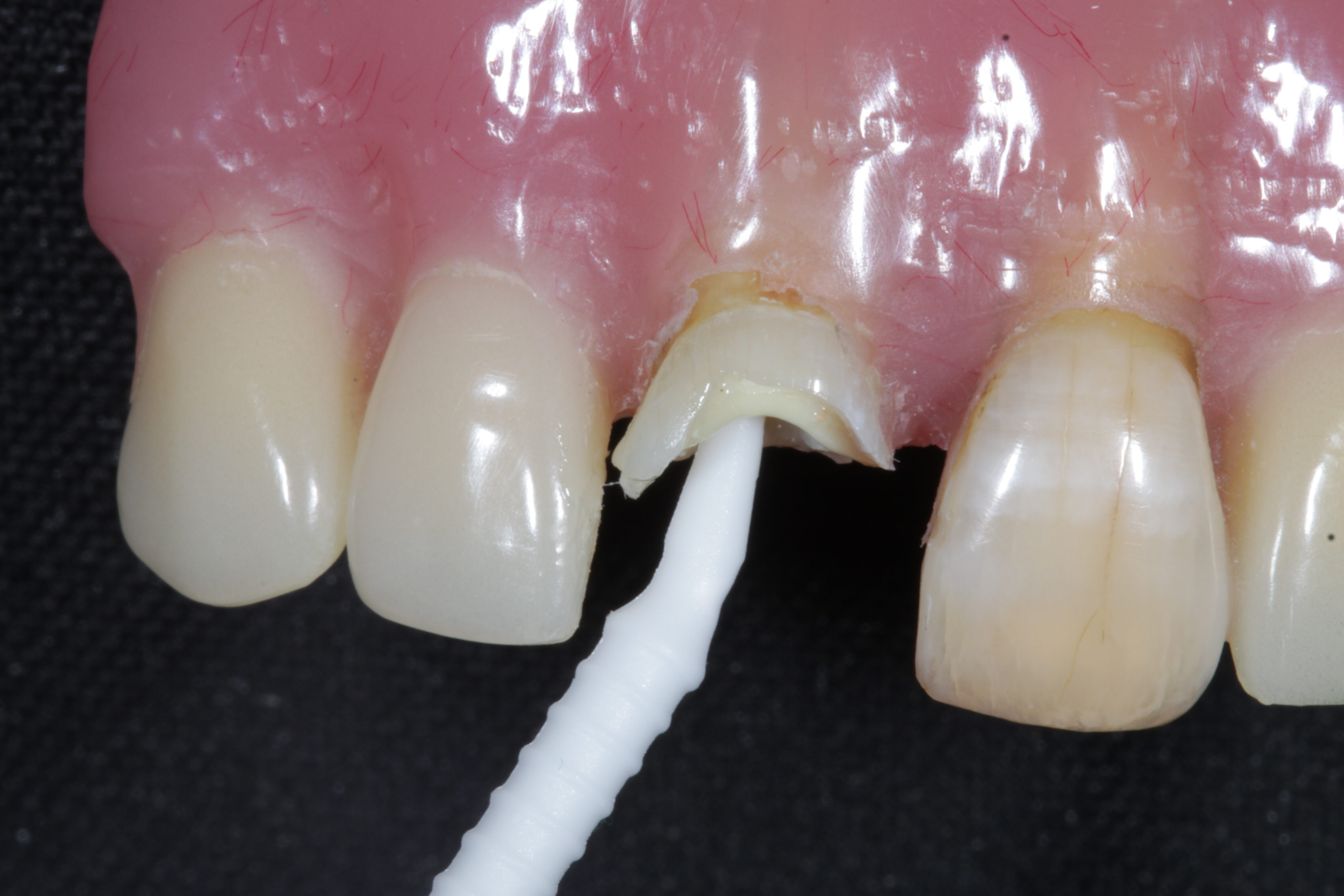 MiCD Fiber Filling: 4R protocol and applications